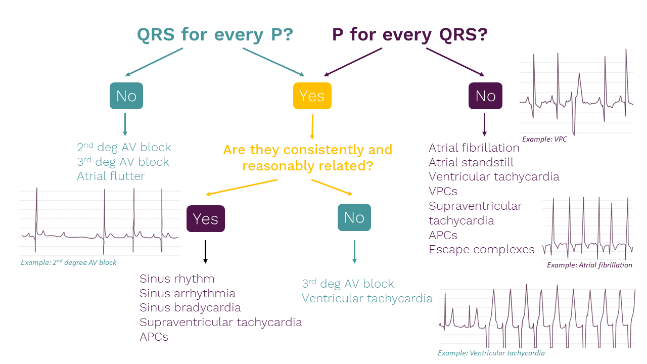 Electrocardiographs for veterinary nurses - Veterinary Practice
