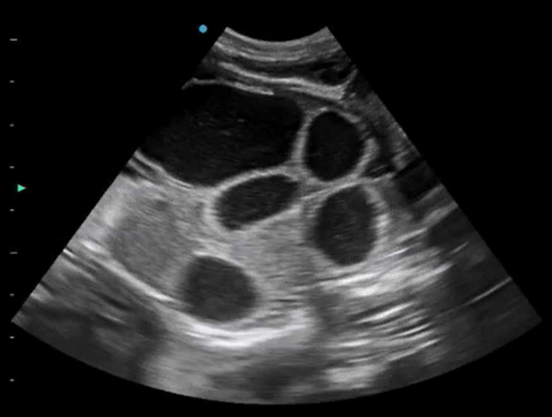 Small animal pregnancy scanning using ultrasound: introducing key ...