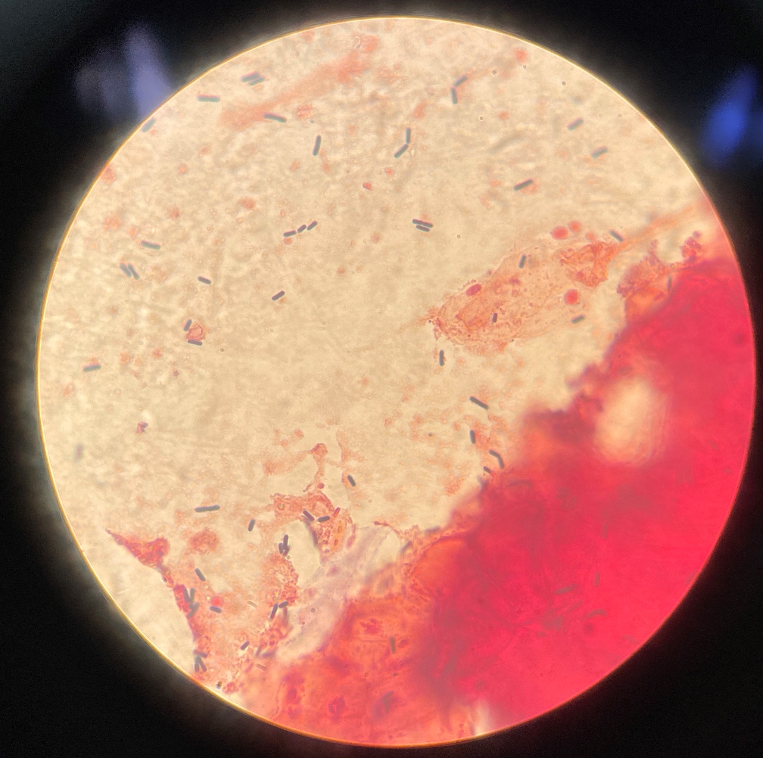 Diagnostic sampling for infectious diseases in avian patients ...