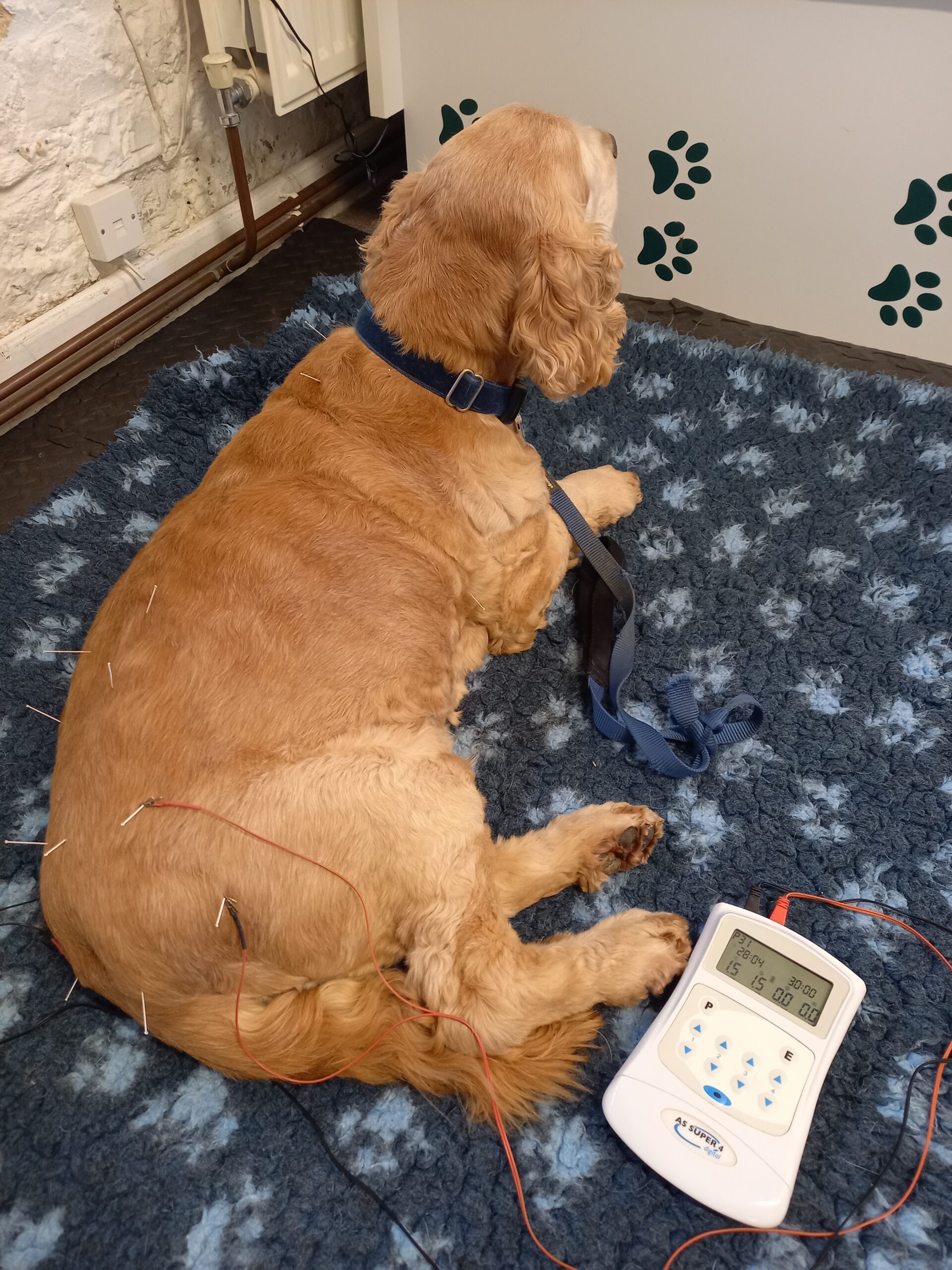 Leg Acupuncture